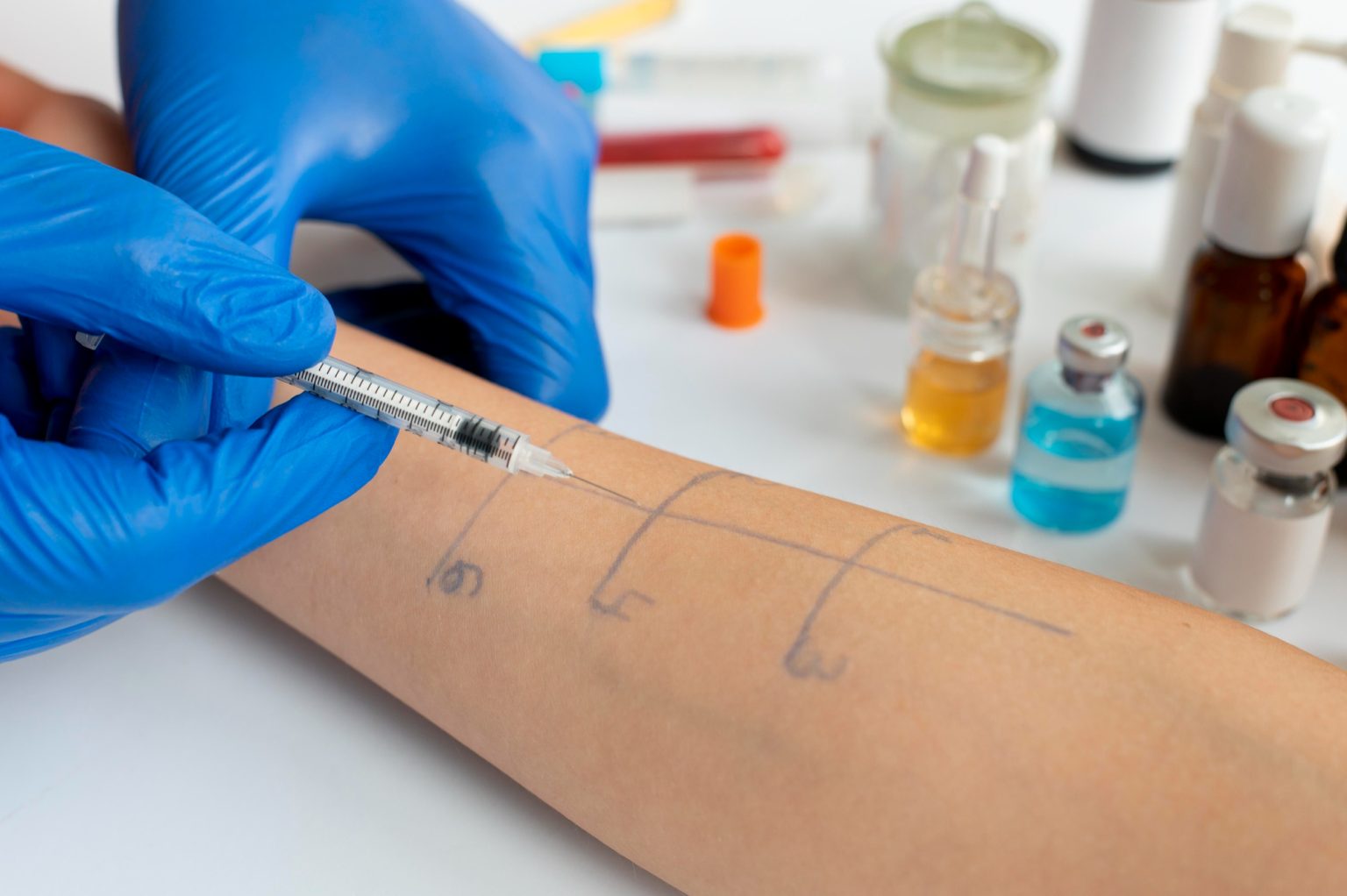 Platelet Rich Plasma Injection - Dr Rob Collins